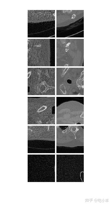 MATLAB图像处理：139：使用 CycleGAN 的医学图像无监督去噪 - 知乎