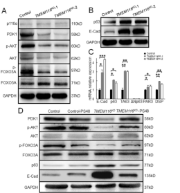 TMEM116促进肺癌细胞运动和转移的机制研究 - 知乎
