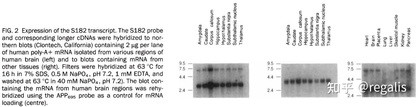 presenilin-1/2的发现与early-onset AD - 知乎