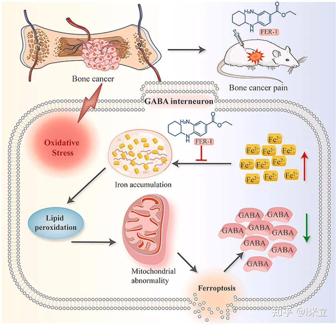 铁死亡的新作用：脊髓神经元-Ferroptosis参与骨癌痛 - 知乎