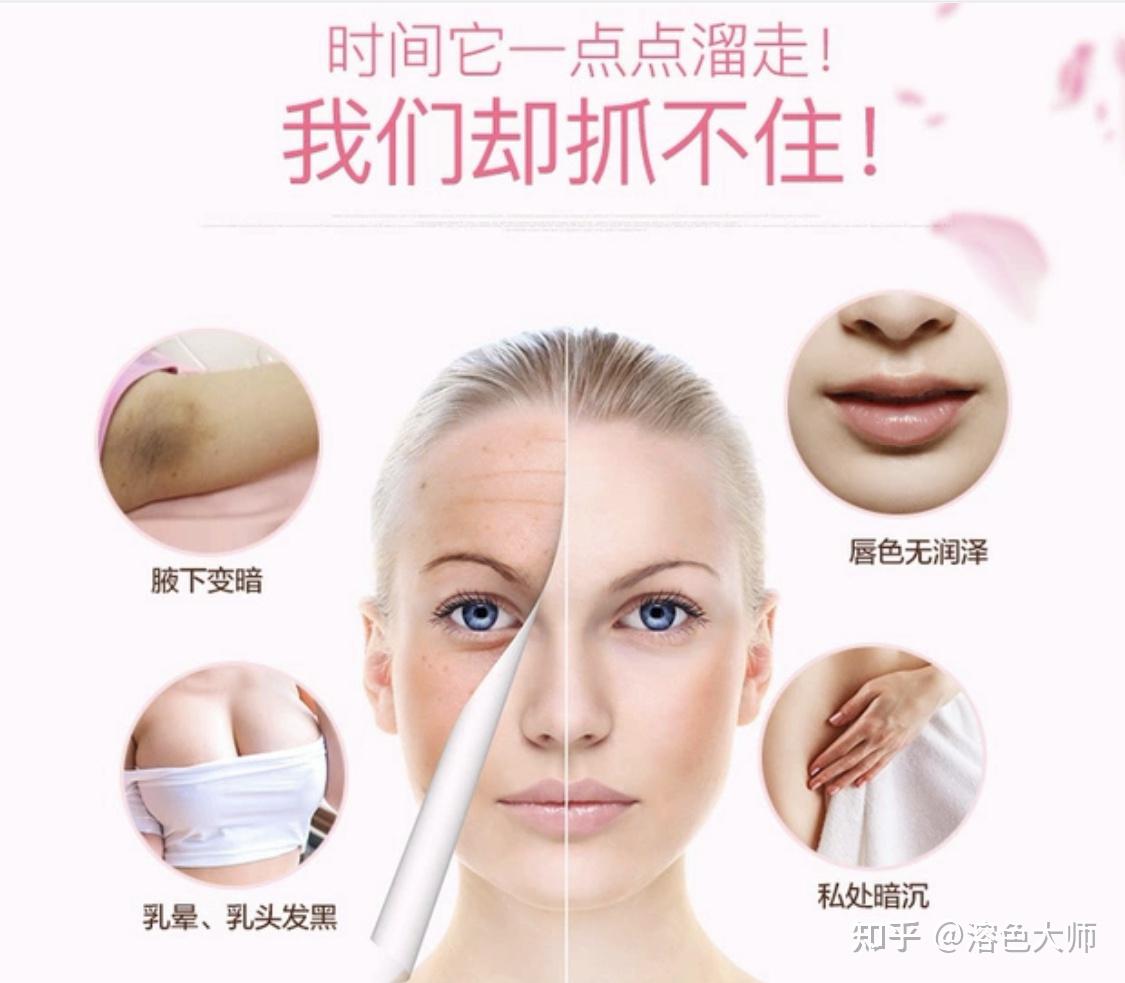 黑色素沉淀是怎么形成的？ 知乎