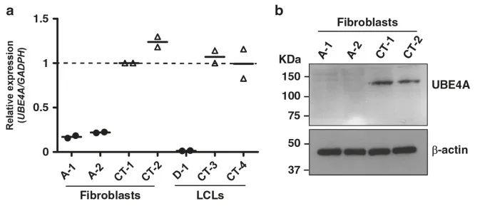 【前沿速递】UBE4A 基因双等位功能丧失变异导致智力障碍和整体发育迟缓 - 知乎