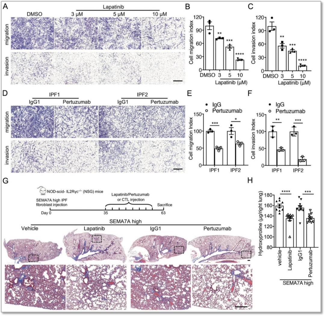 J Exp Med︱蒋典华团队揭示HER2是调控肺成纤维细胞侵袭和肺纤维化新靶点 - 知乎