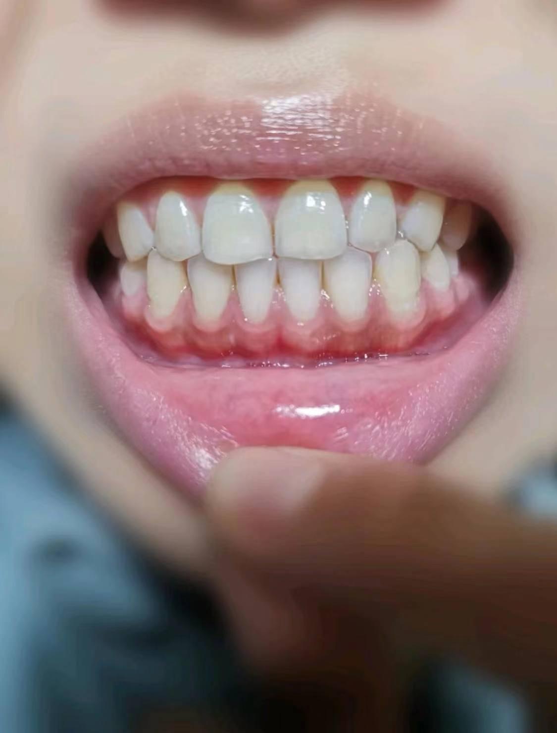 你用过最棒的牙膏是哪一款？ - 知乎