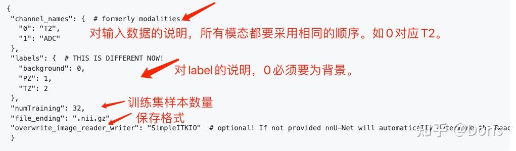 如何用nnunet实现自己的分割任务（Ubuntu系统） - 知乎