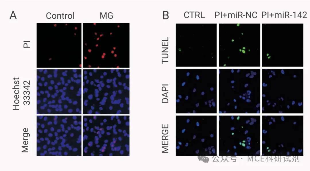 细胞凋亡检测方法有哪些？常用的细胞凋亡检测实验步骤 | MCE - 知乎