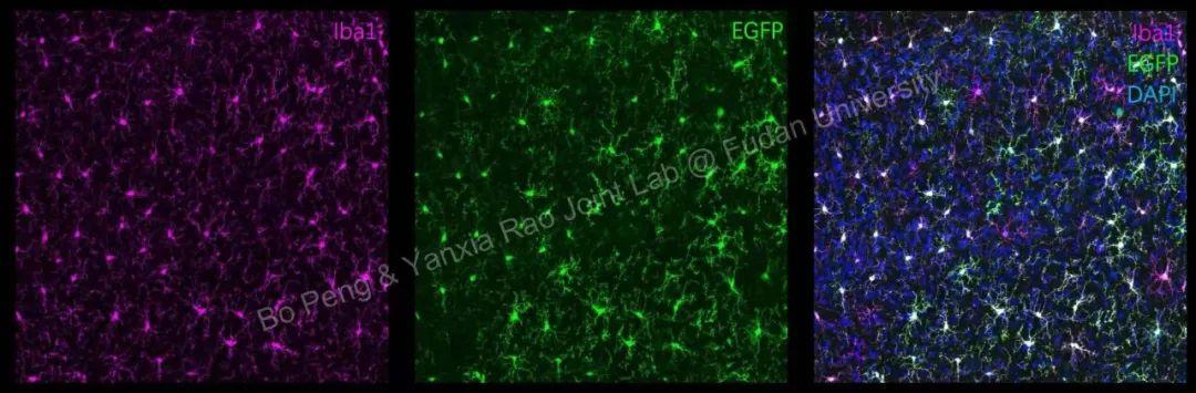 【新品推荐】突破性进展！德克萨斯大学张春立教授团队开发截短启动子hIBA1a实现AAV介导的小胶质细胞高效精准靶向 - 知乎