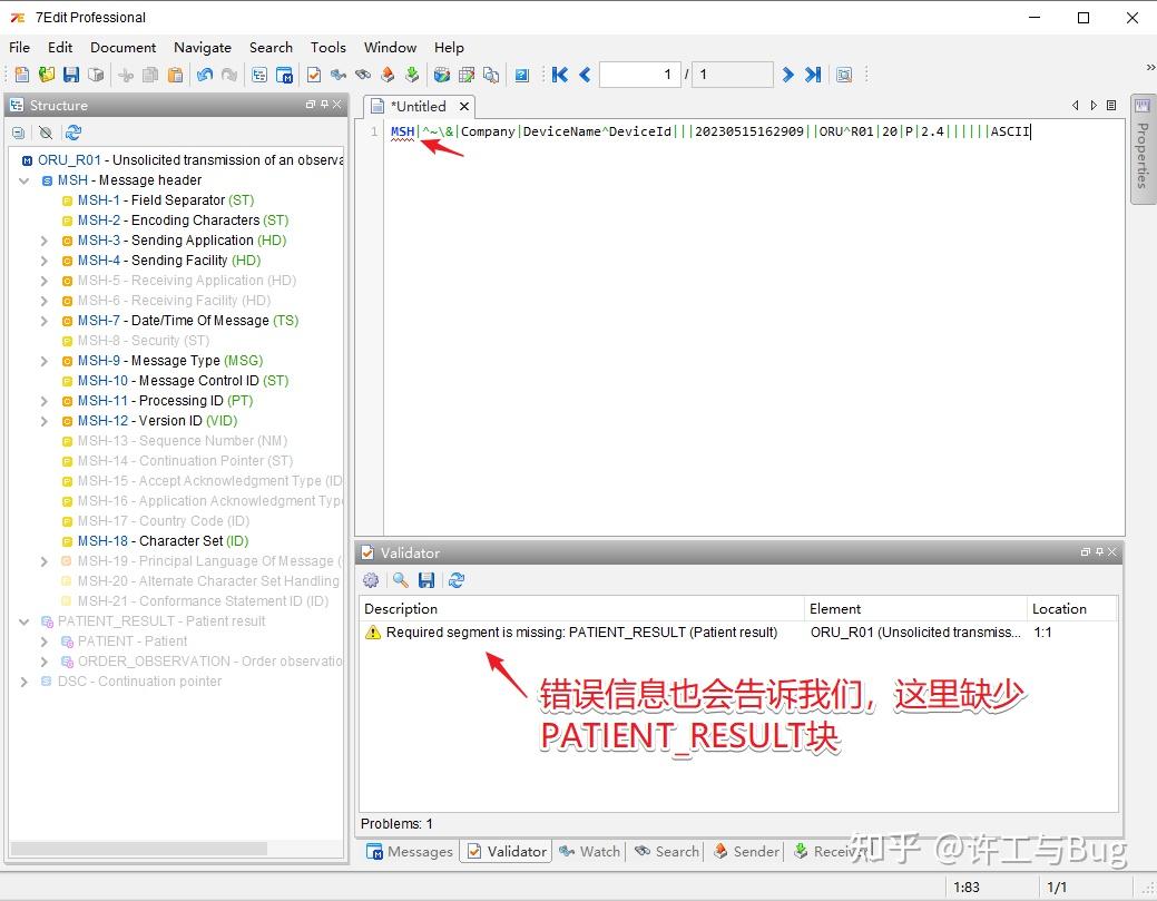 HL7辅助工具7Edit怎么使用？ - 知乎