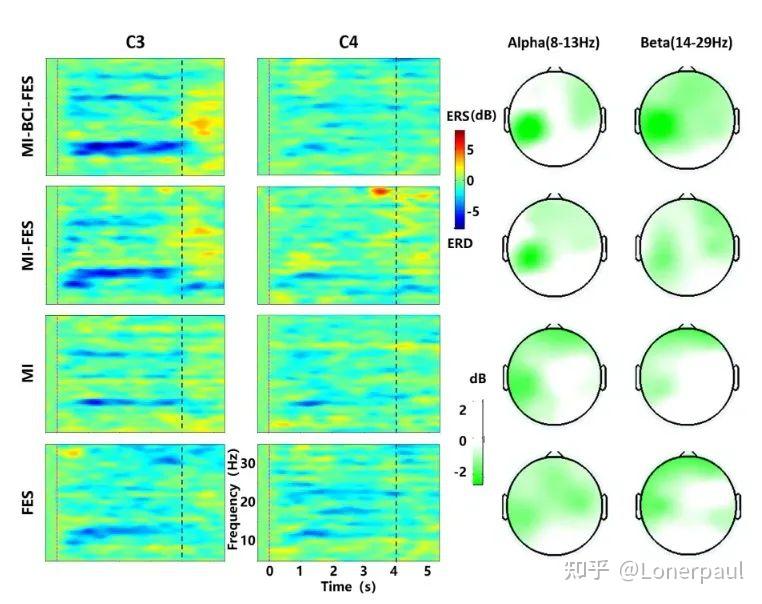 EEG-FNIRS-FES多模态研究 - 知乎