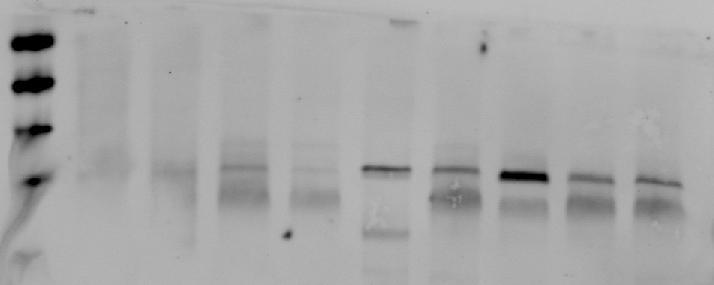 SDS-PAGE实验报告 - 知乎