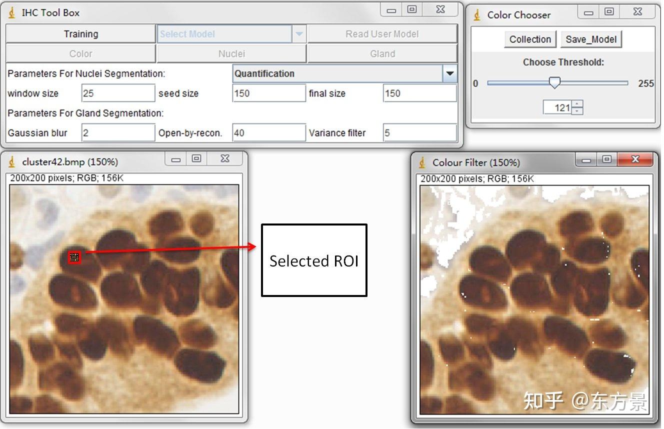 ImageJ | 免疫组织化学（IHC）图像分析工具箱 | 下载地址 | 安装教程 | 使用教程 - 知乎