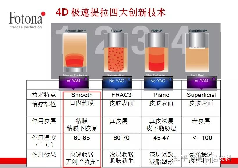 硬科普 | 欧洲之星Fotona4D Pro最新解答！ - 知乎