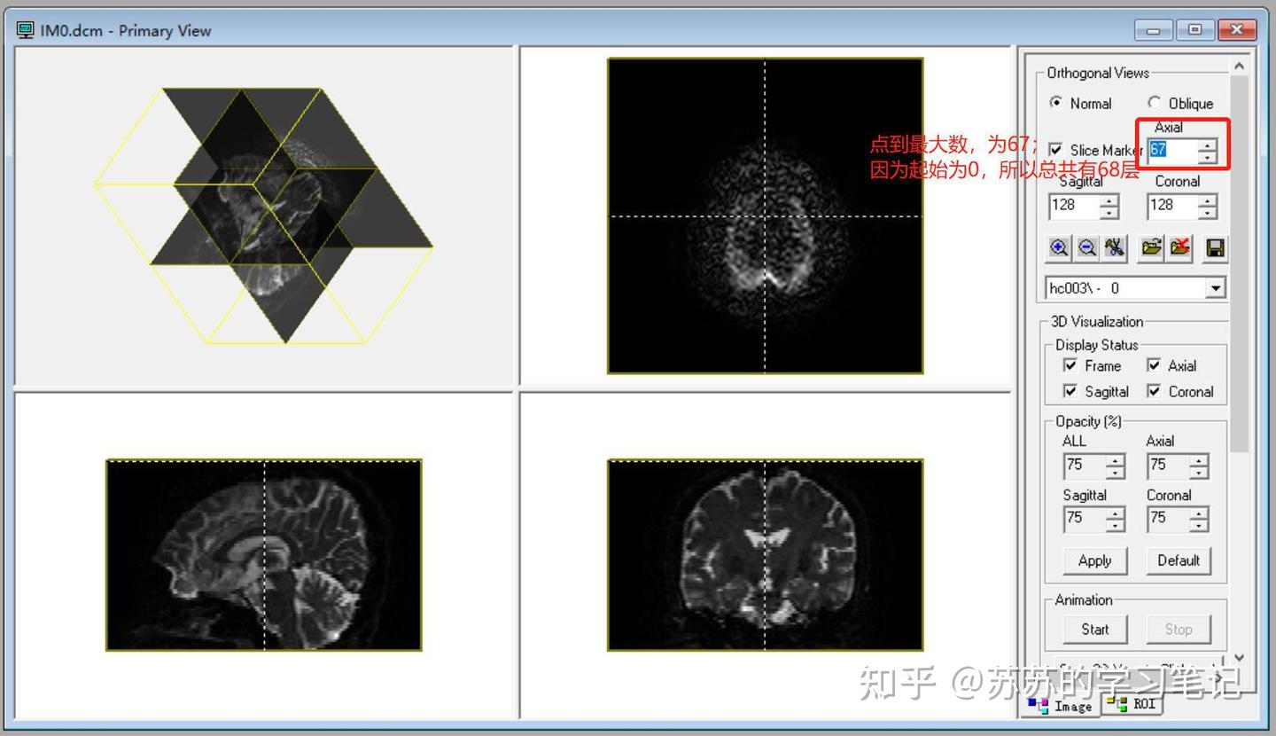 DTI Studio操作教程 - 知乎