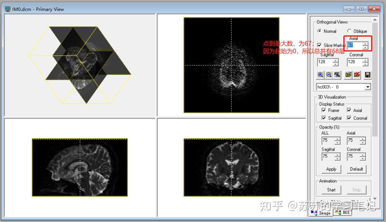 DTI Studio操作教程 - 知乎
