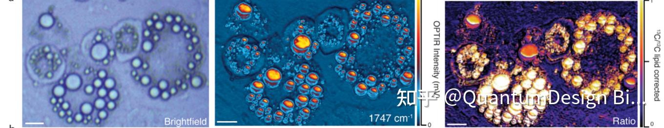 耶鲁大学新进展！探索活细胞脂肪代谢过程：光学红外显微成像技术揭开DNL的奥秘 - 知乎