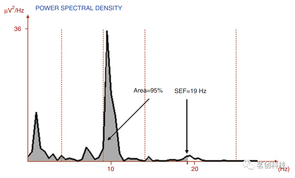脑电信号分析 - 知乎