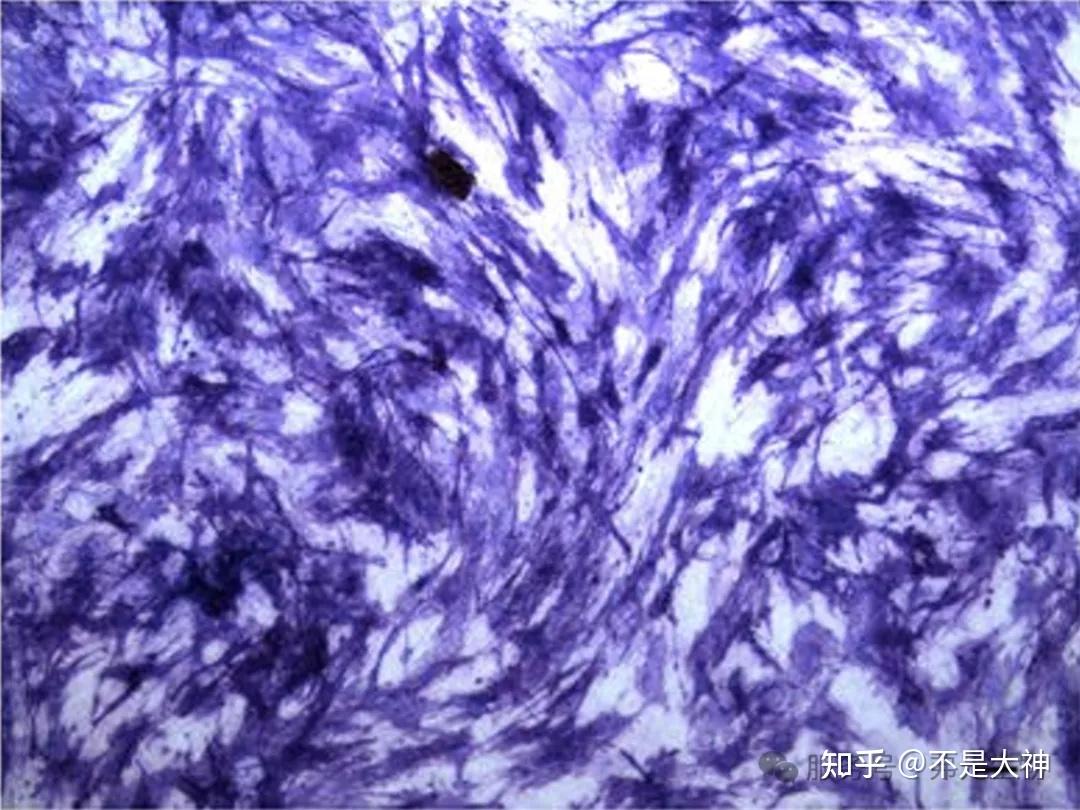 间充质干细胞成骨诱导鉴定之标志物检测 - 知乎