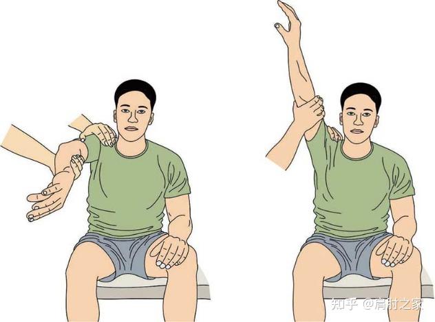 带您了解肩峰下撞击综合征 - 知乎