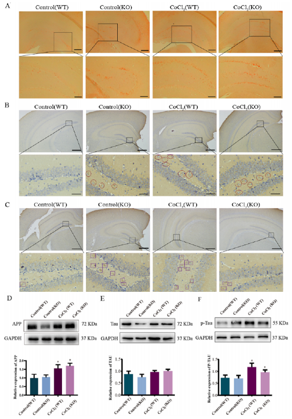 用户文章m6A专题|IF=9.8|m6A去甲基化酶ALKBH5缺乏会加重钴致神经退行性损伤 - 知乎