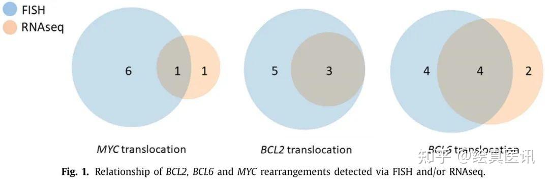 RNA测序联合FISH更精准！提高侵袭性B细胞淋巴瘤BCL2、BCL6和MYC重排检出率 - 知乎