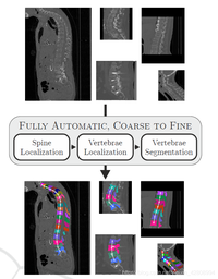 Coarse to Fine Vertebrae Localization and Segmentation with SpatialConfiguration-Net and U-Net - 知乎