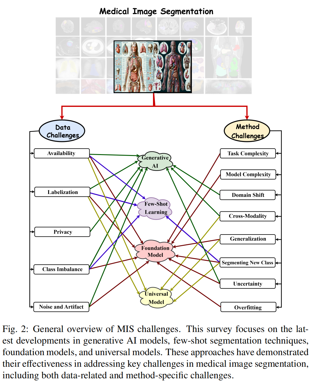 Medical Image Analysis：医学图像分割最新进展综述 - 知乎