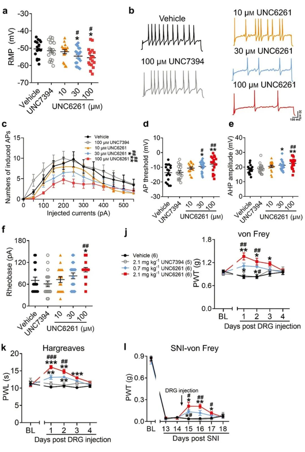 IF=17.521【客户文章】Adv Sci：北京大学基础医学院王韵教授团队揭示痛觉表观调控新机制，并开发新型镇痛药 - 知乎