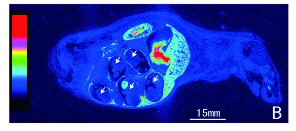 定量全身放射性自显影技术（QWBA）使组织分布实现可视化 - 知乎
