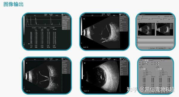 ODU5全数字眼科AB型超声诊断仪 - 知乎