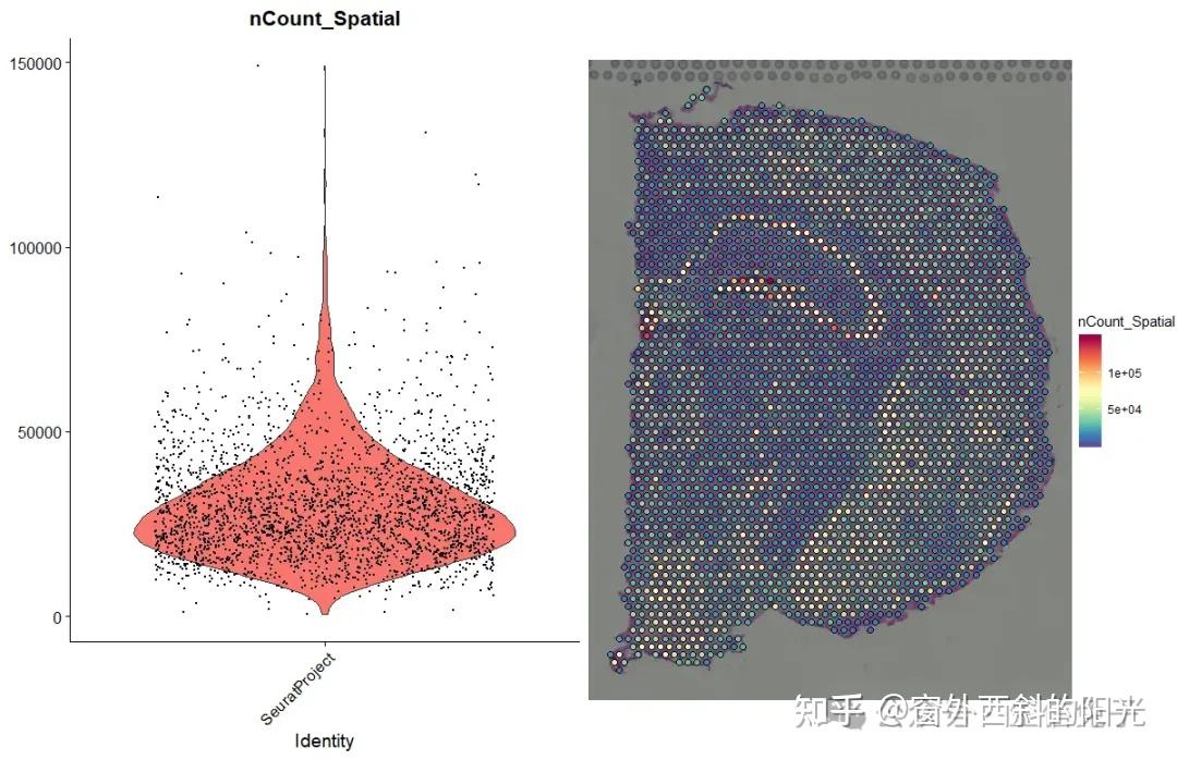 10X空间转录组 | Seurat 分析Visium空间转录组代码实操 - 知乎