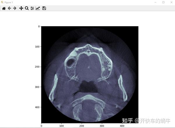 Python numpy处理dcm三维图像 - 知乎