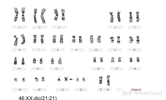 染色体结构重排 - 知乎