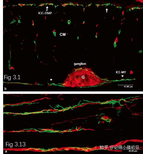 Cajal间质细胞的分类 - 知乎