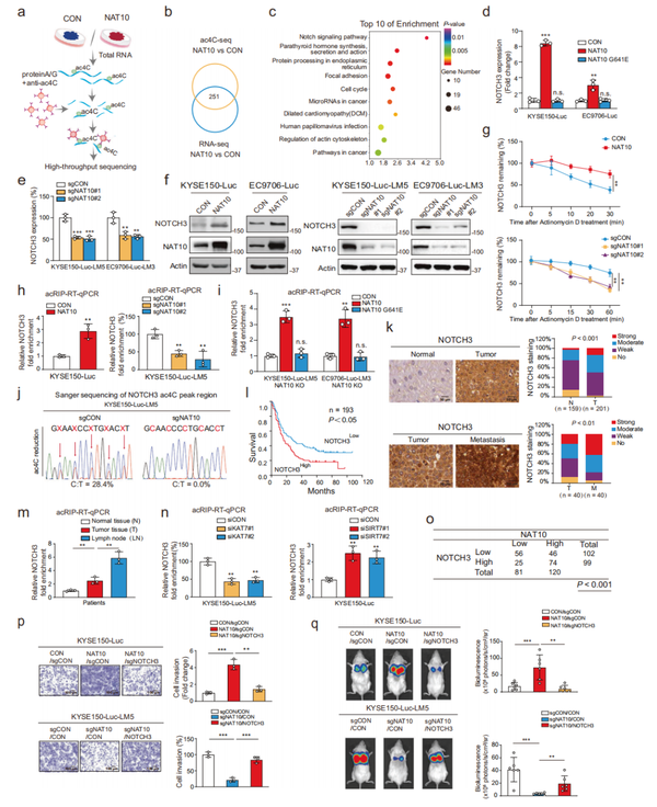 Cell Res | 广州医科大学李斌团队2-羟基异丁酰化修饰研究揭示癌症转移全新机制 - 知乎