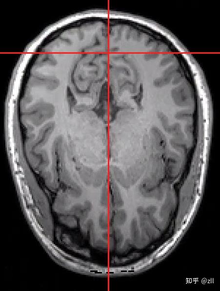 part1 spm中fmri数据预处理 - 知乎