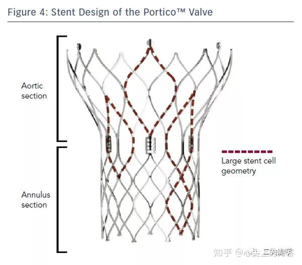 连合对齐（Commissural Alignment）：原理、定义、技术和结果（中） - 知乎