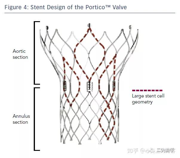 连合对齐（Commissural Alignment）：原理、定义、技术和结果（中） - 知乎