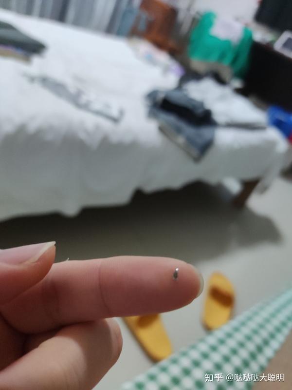 分享自己包皮环切术的经历2022712 2022 825(下换药及脱钉过程) 知乎