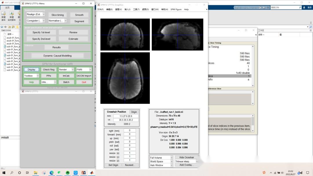 如何用SPM完成fMRI数据的预处理【任务态】 - 知乎