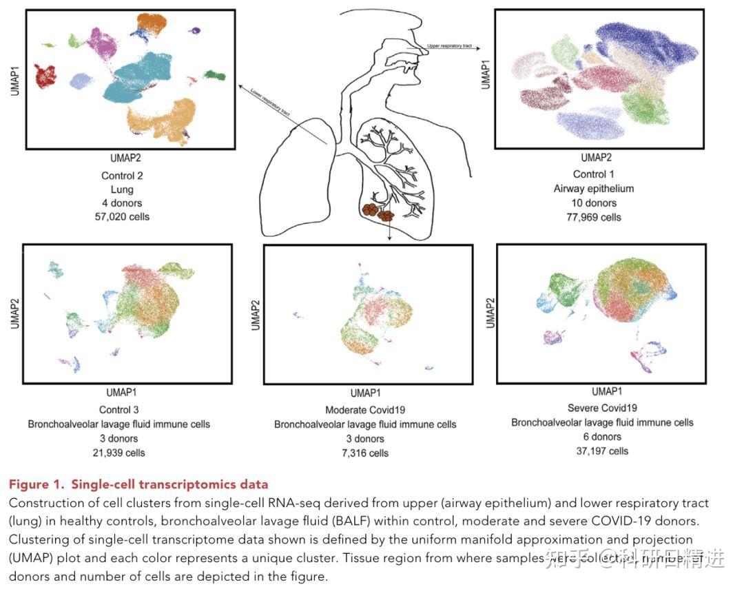 iScience丨单细胞转录组鉴定出FCGR3B 在重症新冠患者中上调 - 知乎