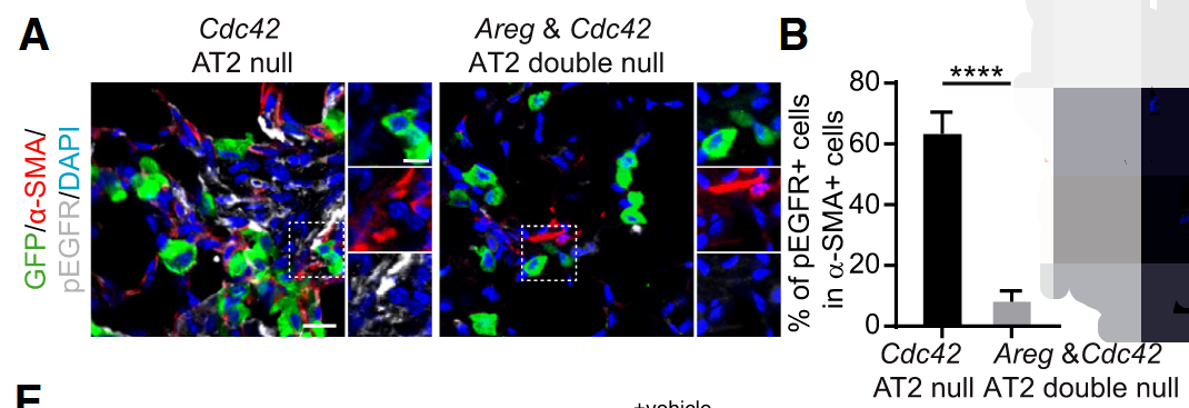 240919 文献精读Plus Cell Stem Cell AREG+肺纤维化 - 知乎