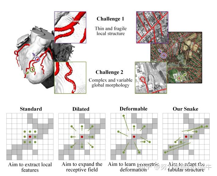 动态蛇形卷积（Dynamic Snake Convolution)-[分割检测头] - 知乎