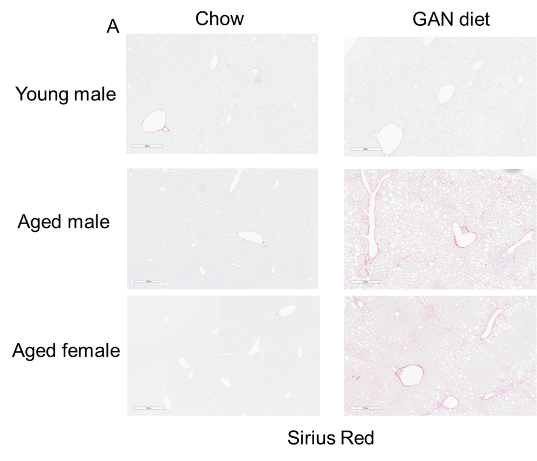 GAN饮食诱导NASH模型 | 老龄鼠再展新风采，助力NASH药物研发 - 知乎