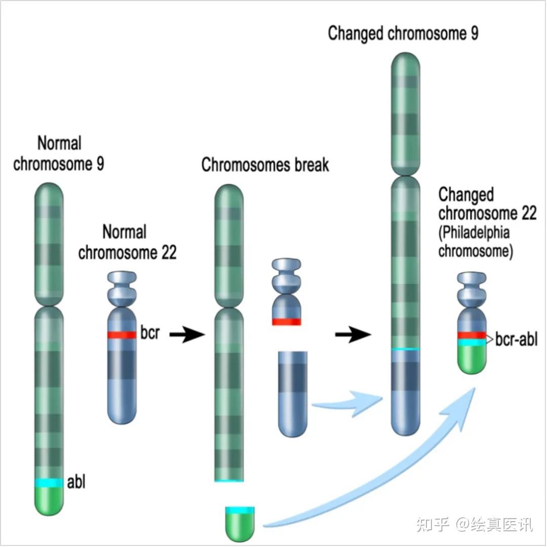 【绘真科普】血液肿瘤BCR-ABL1融合变异检测，该注意哪些事项？ - 知乎