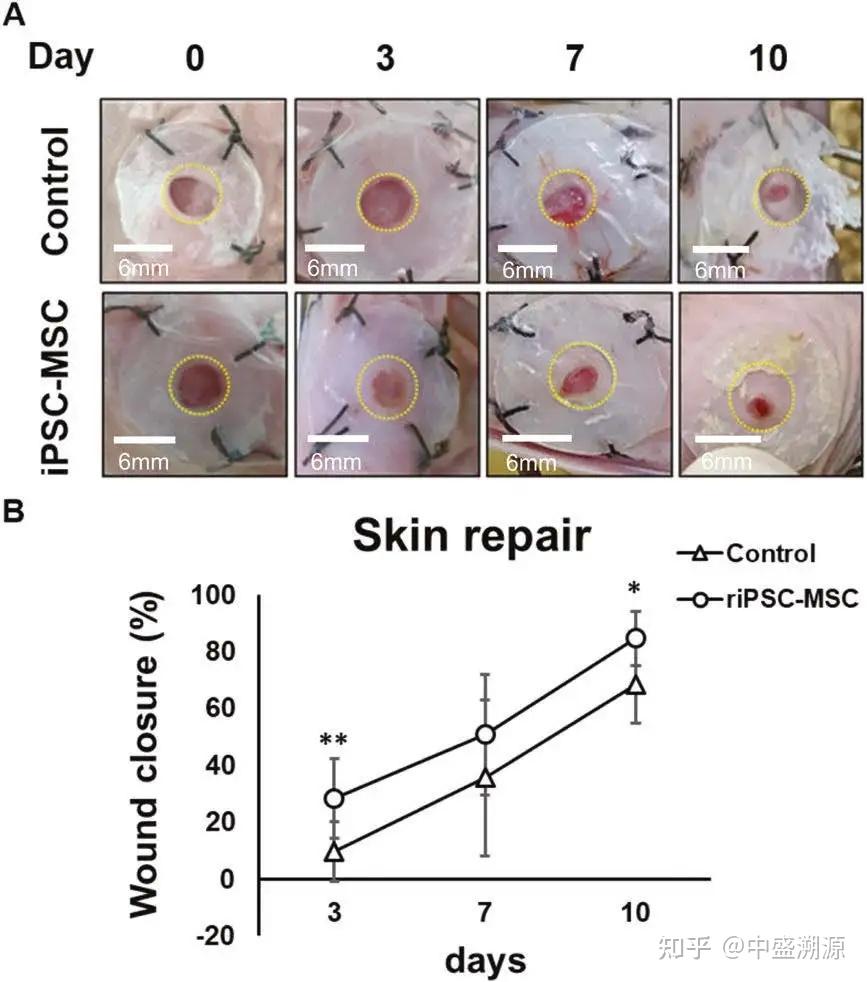 iPSC-MSC：解锁骨关节炎治疗与伤口愈合的新潜力 - 知乎