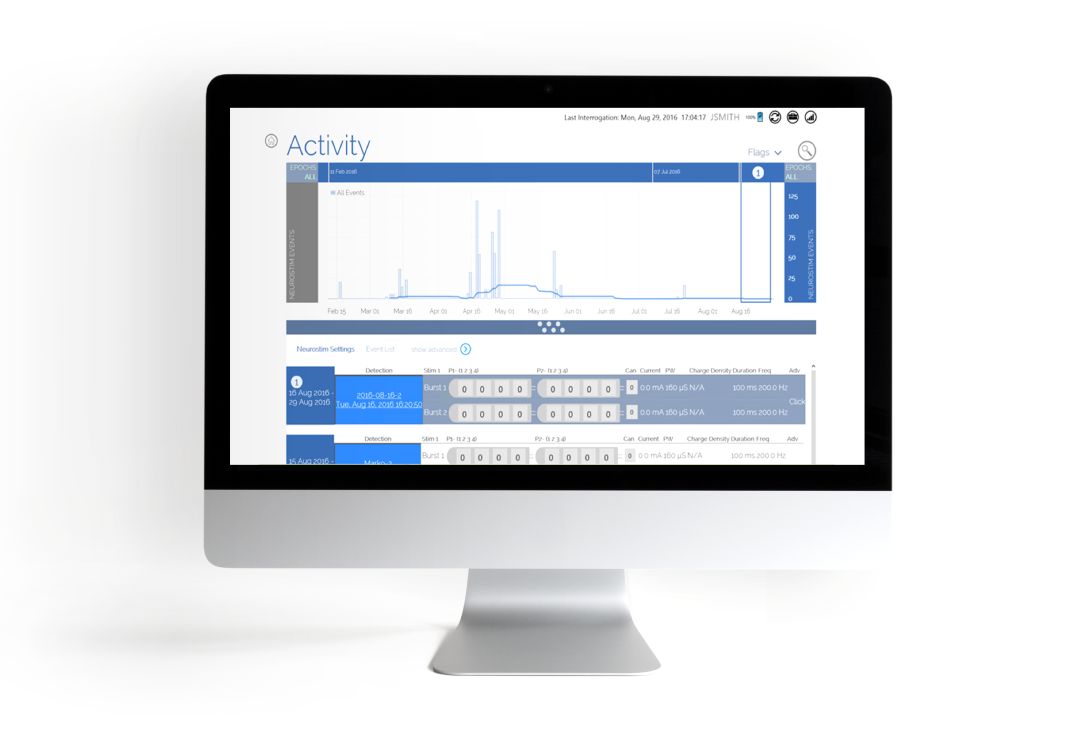 MedTech | NeuroPace开启RNS系统新研究 - 知乎