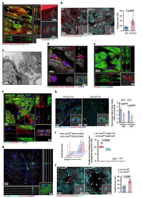 文献解读 | TREM2hi驻留巨噬细胞通过维持心肌细胞稳态来保护脓毒症心脏功能 - 知乎