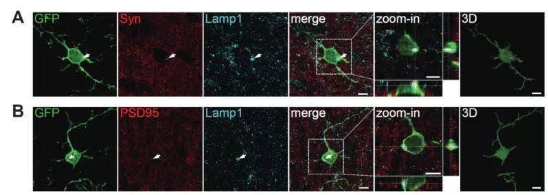 Science | 浙江大学揭示大脑中的免疫细胞竟是记忆遗忘的“主谋” - 知乎