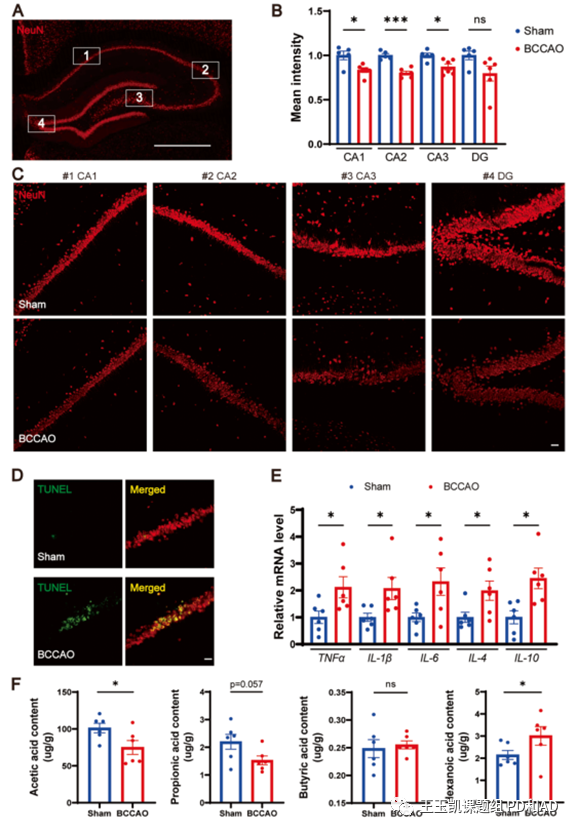 Microbiome | 微生物-肠道-脑轴通过干扰短链脂肪酸的代谢参与慢性脑灌注不足慢性脑灌注不足 - 知乎