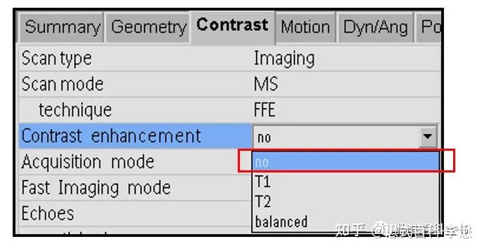 磁共振序列解析之——FFE序列分类 - 知乎